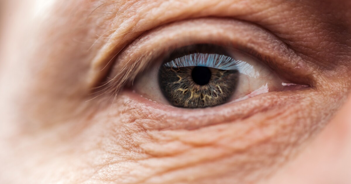 Important Finding May Help Halt Age related Macular Degeneration important-finding-may-help-halt-age-related-macular-degeneration