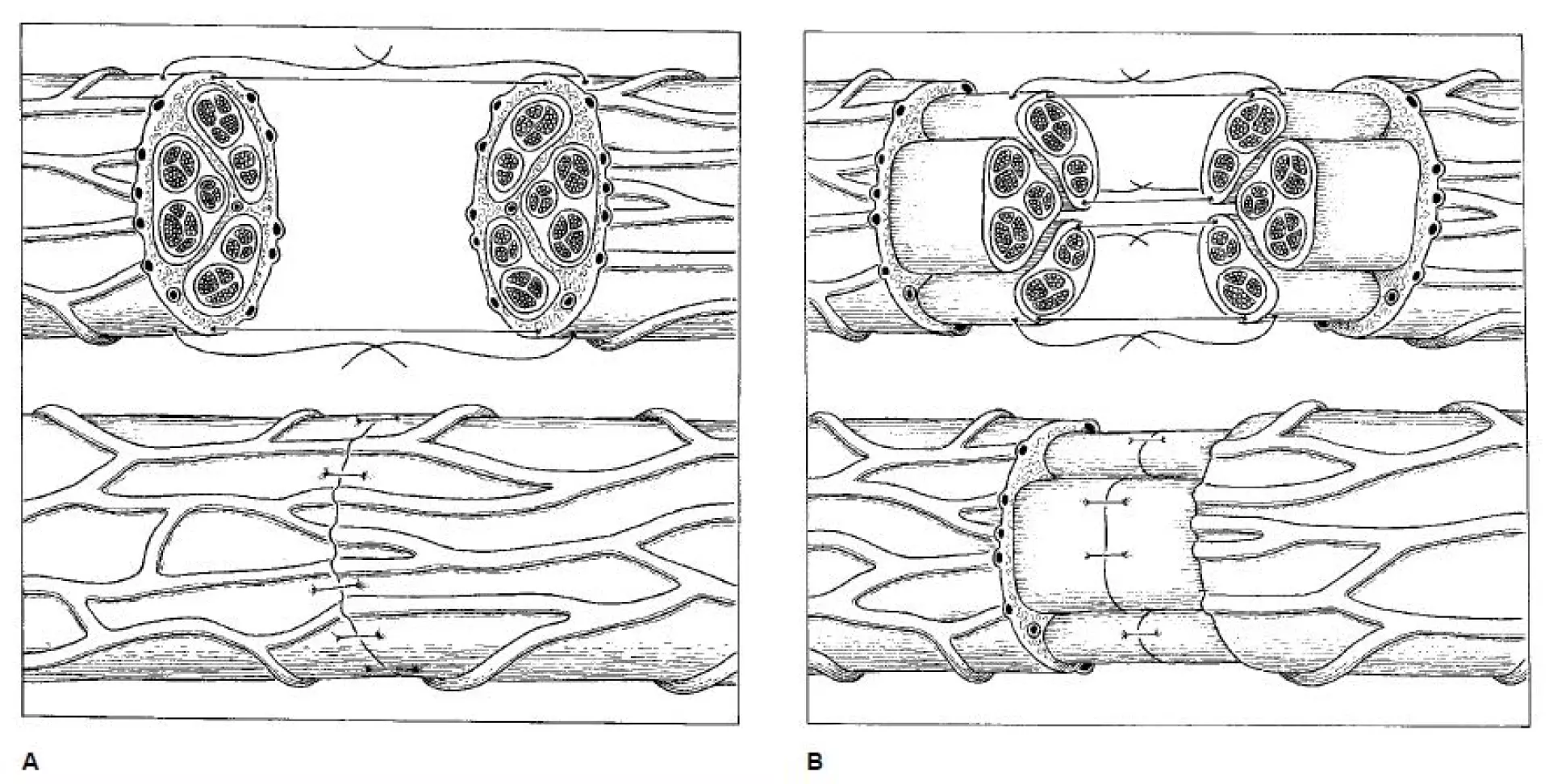 Non-surgical procedure repairs severed nerves in minutes