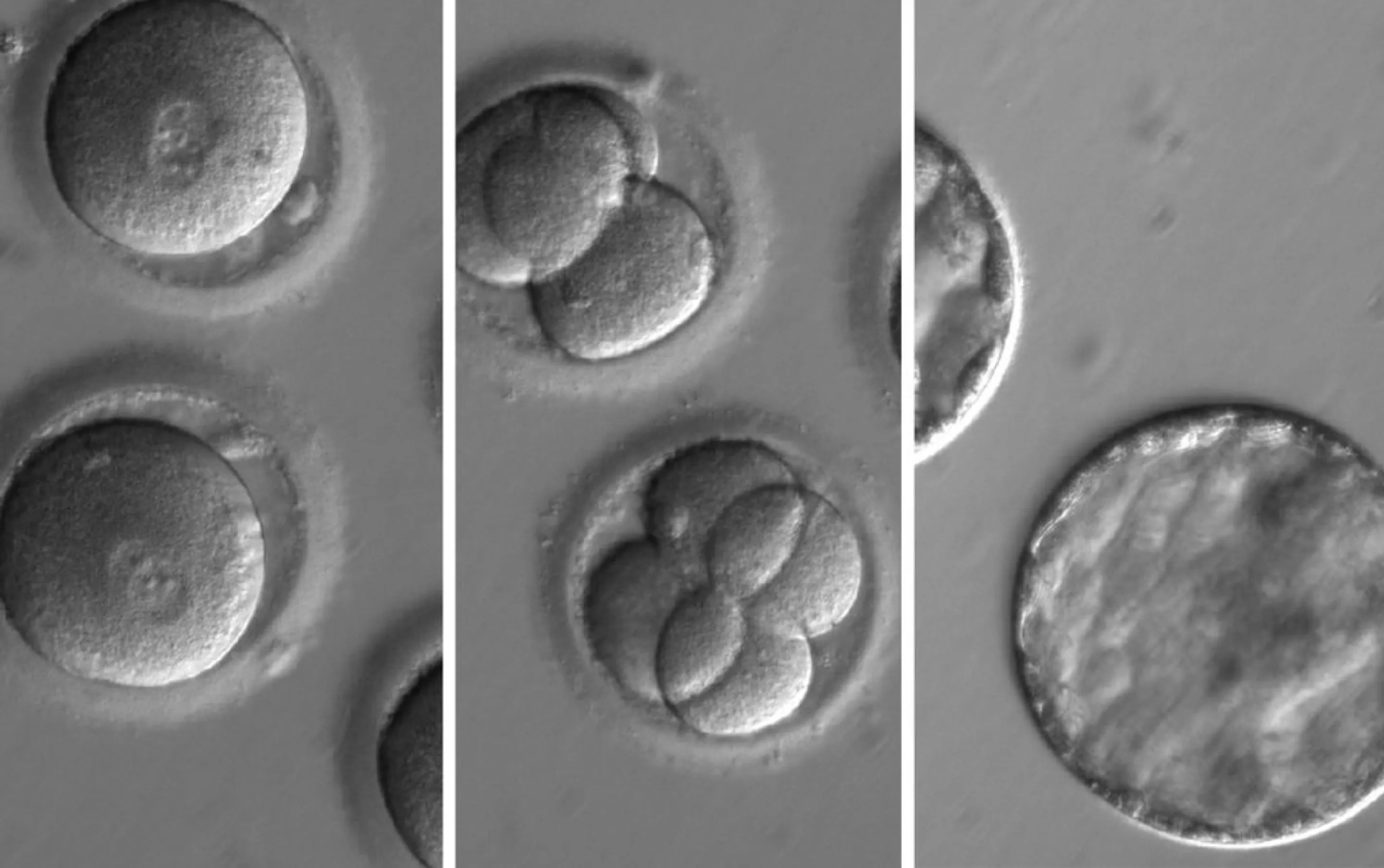 CRISPR successfully removes genetic disease from human embryo