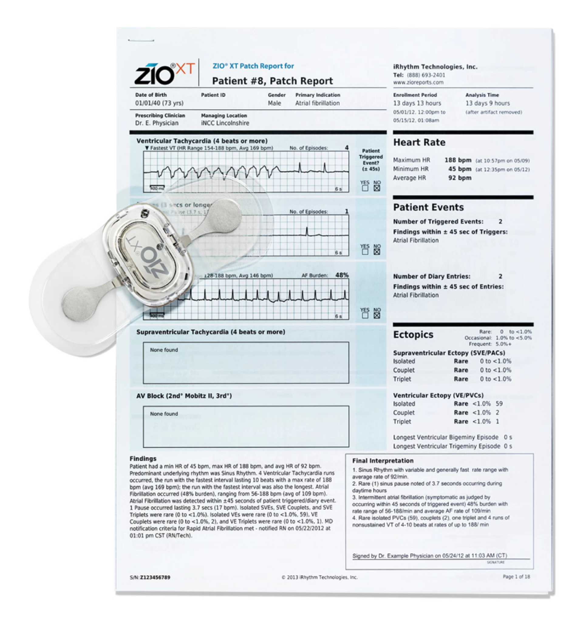 Small adhesive patch outperforms traditional tech for detecting arrhythmia