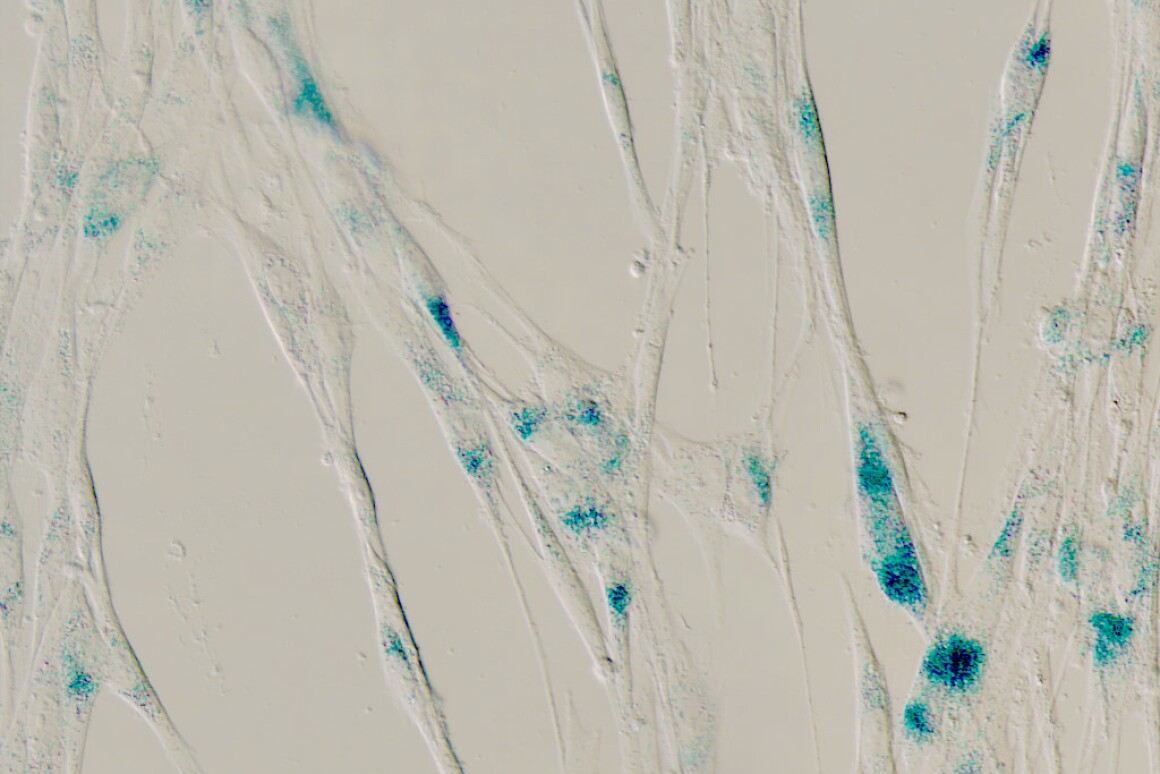 Scientists single out gene that triggers aging symptoms