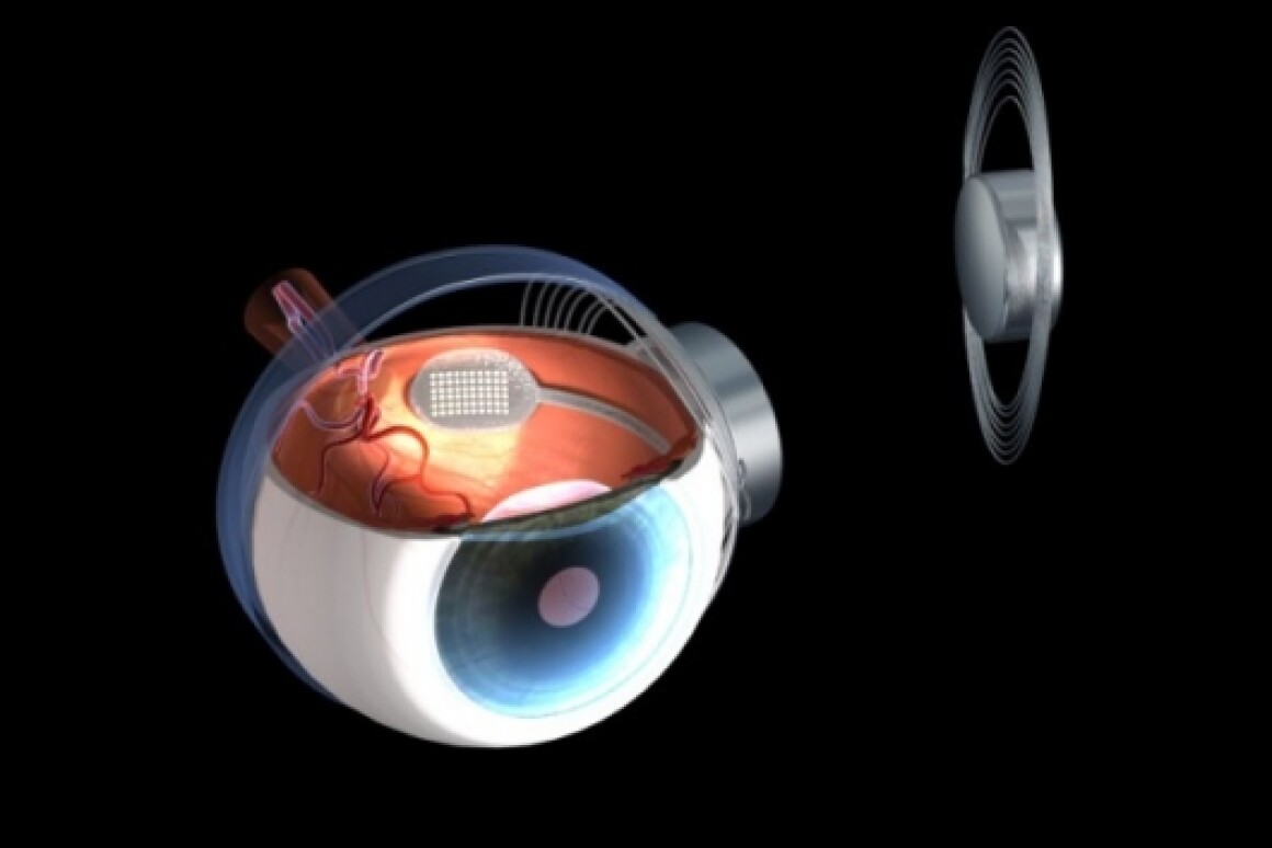 Bionic eye begins to see real-world results