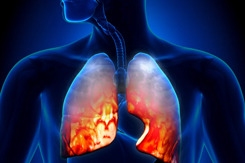 New pneumonia vaccine protects against over 70 strains of the disease