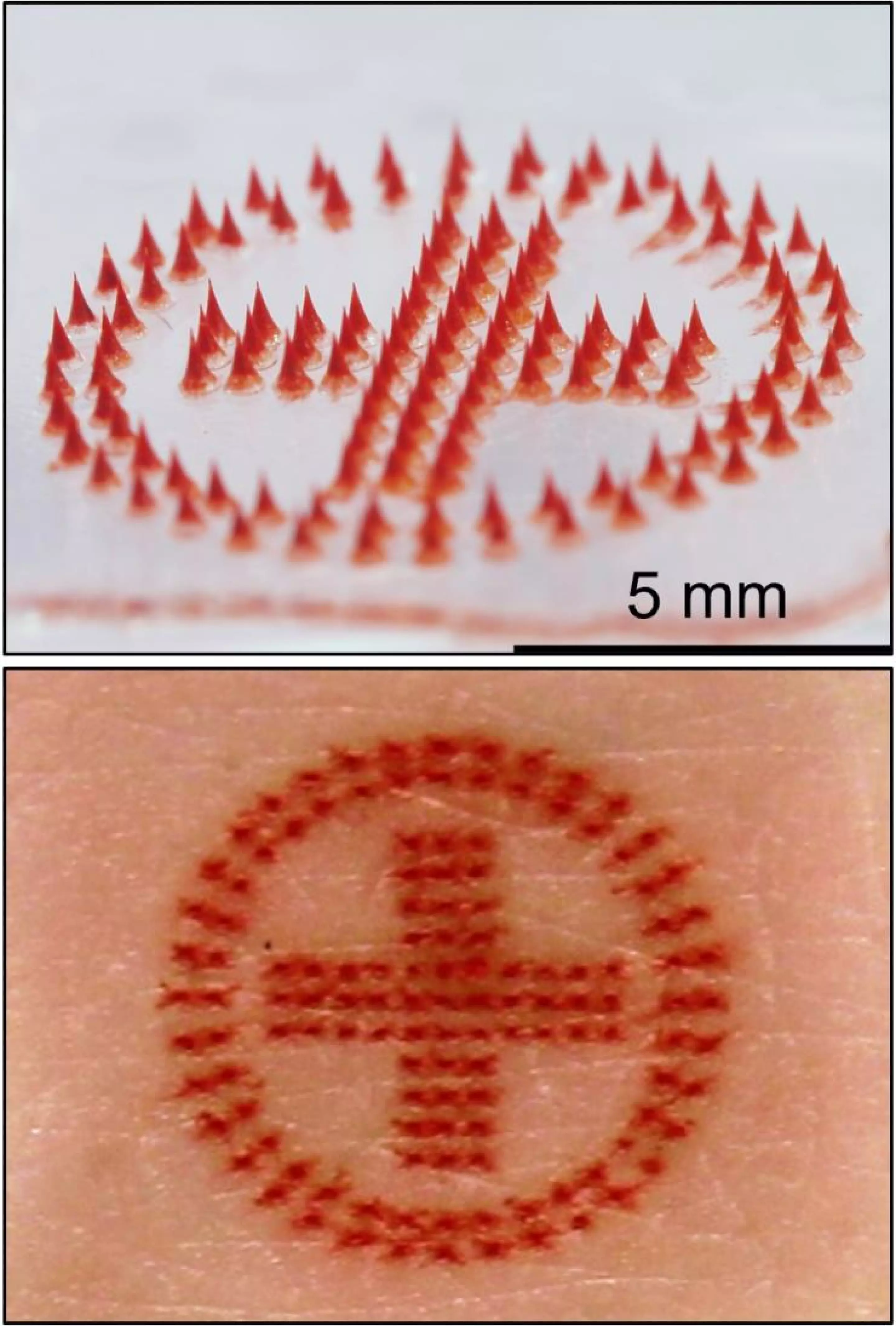 New do-it-yourself microneedle tattoos are painless, quick and cheap