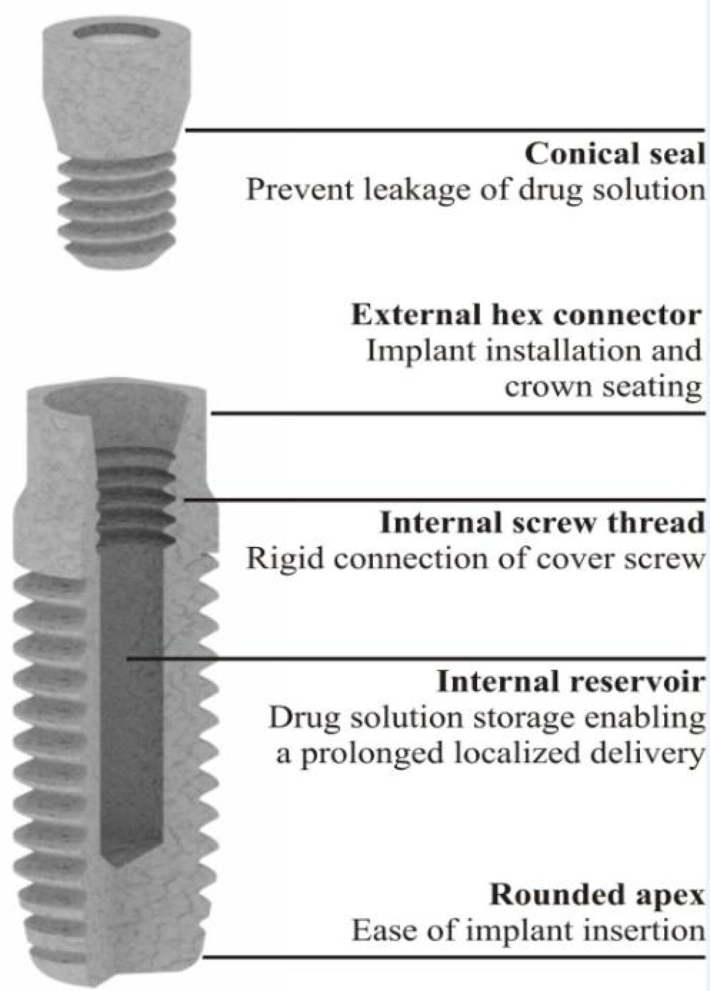 Germ Killing Dental Implant Has A Heart Of Mouthwash