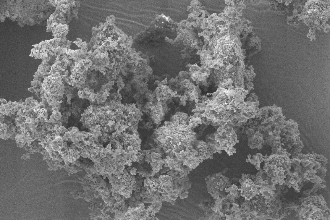 Bioactive glass may find use in longer-lasting dental fillings