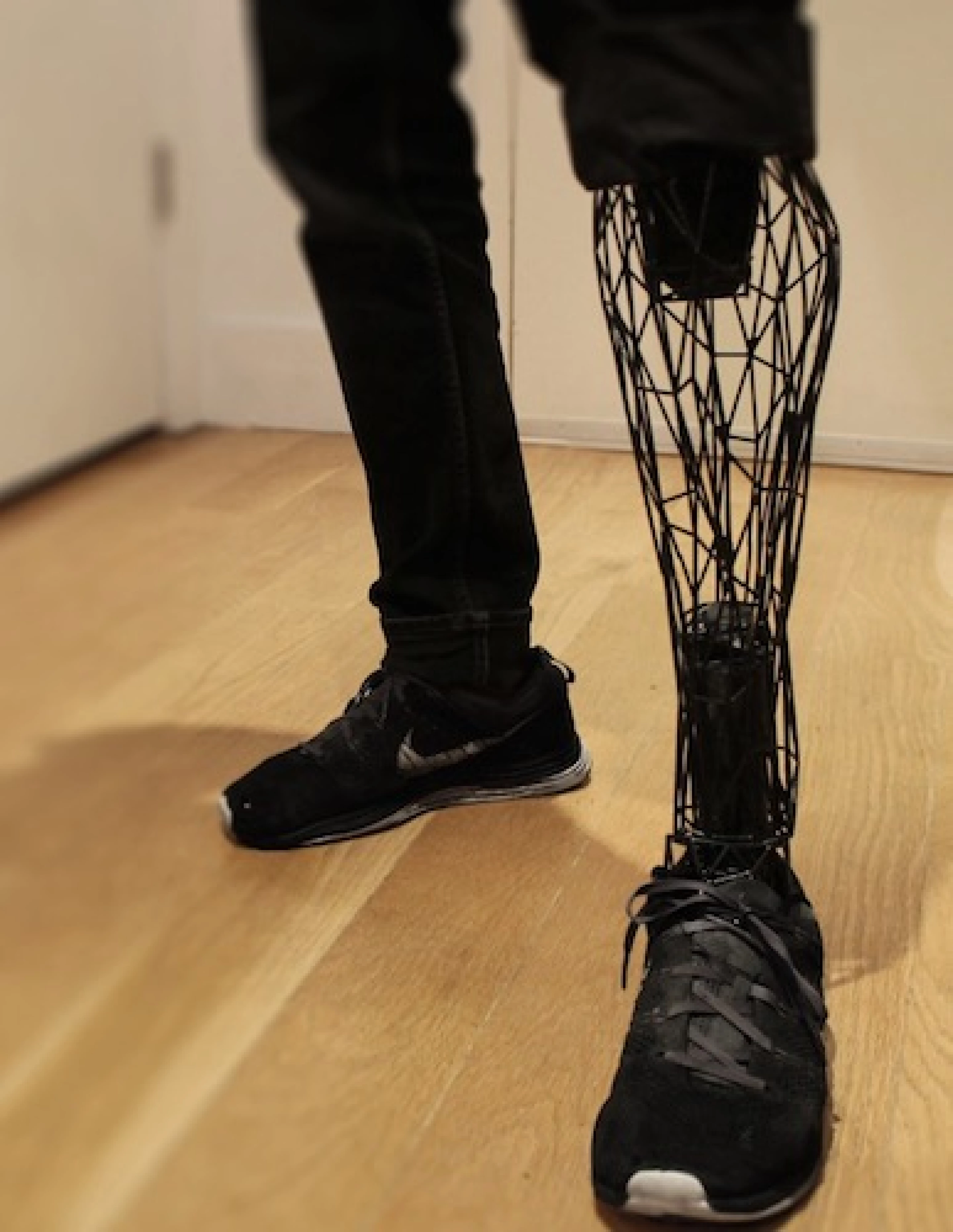 3D printed Exo-Prosthetic leg designed to be affordable – and beautiful