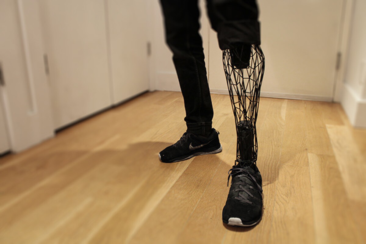 3d printed prosthetics