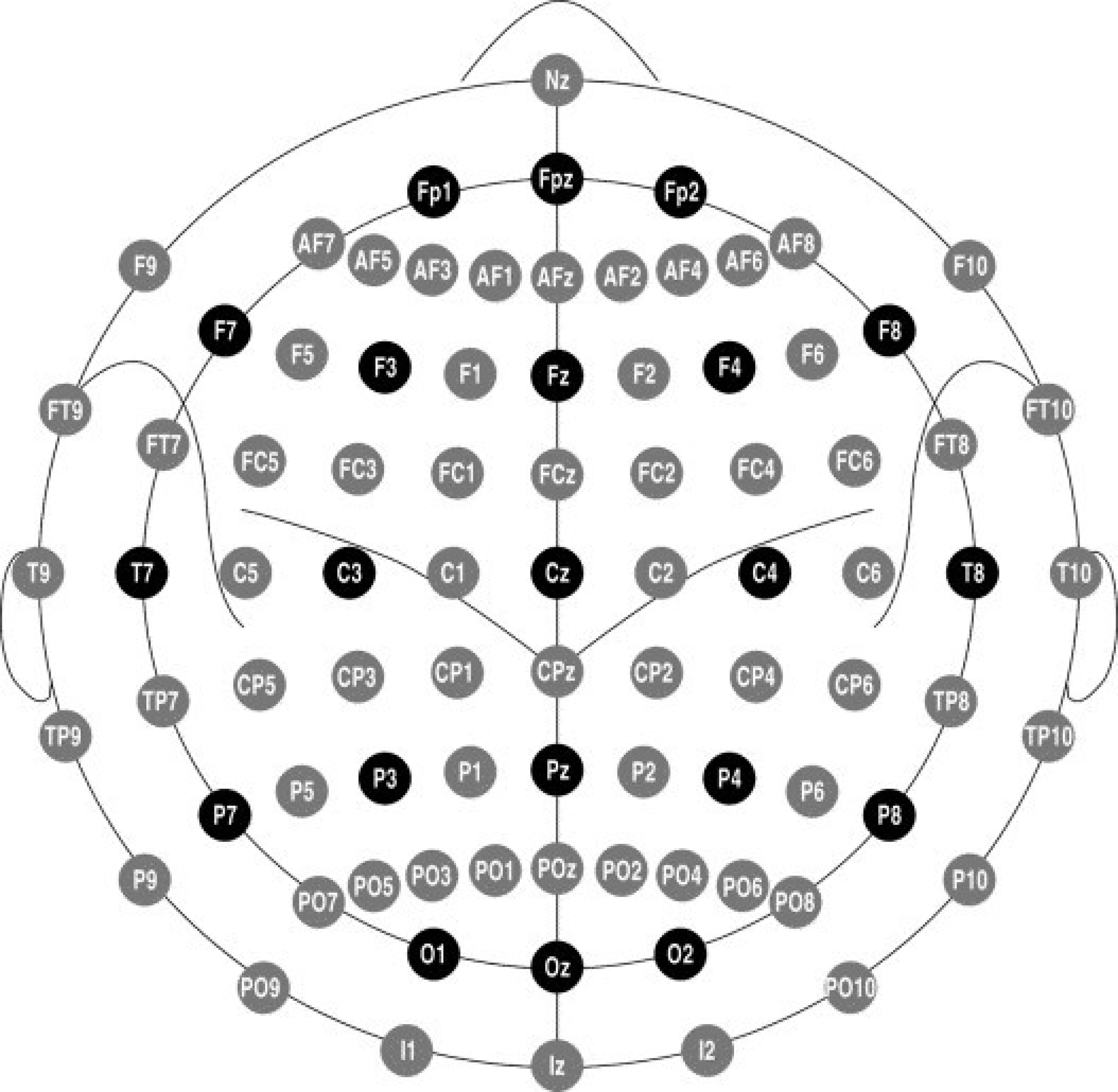 3D-printed EEG headset from OpenBCI is customizable and open-source
