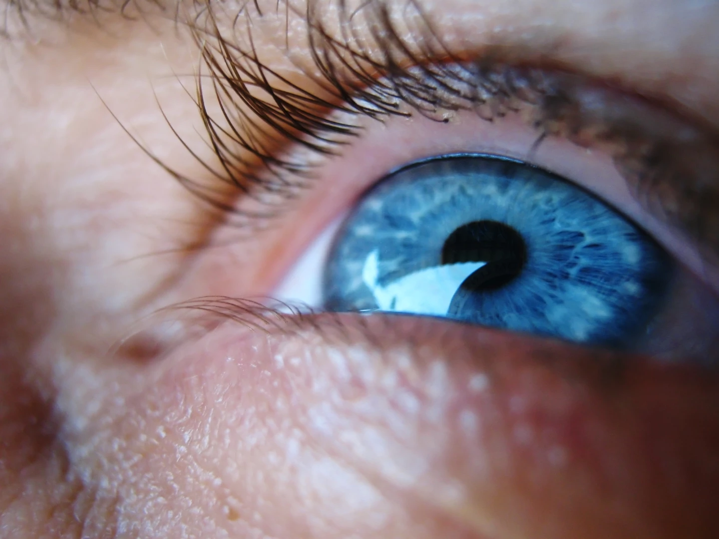 Stem Cells Restore Vision To Patients With Eye Injuries In Clinical Trial