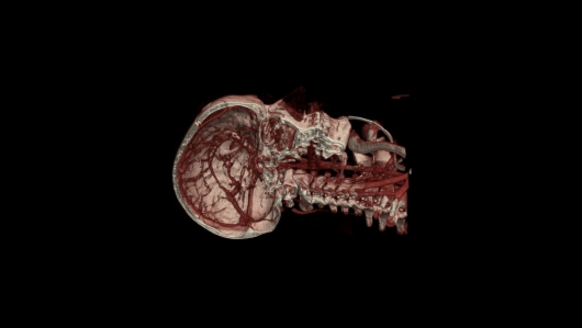 The interactive 3D Virtual Autopsy Table