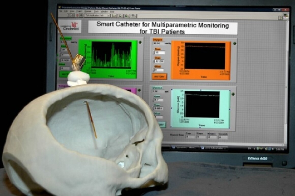 Researchers develop smart monitoring device for brain injury