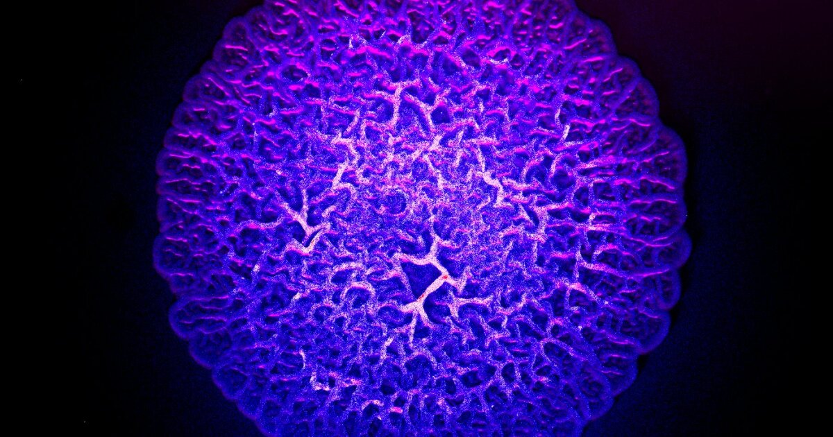 New mechanism controls superbugs by sparing the death sentence