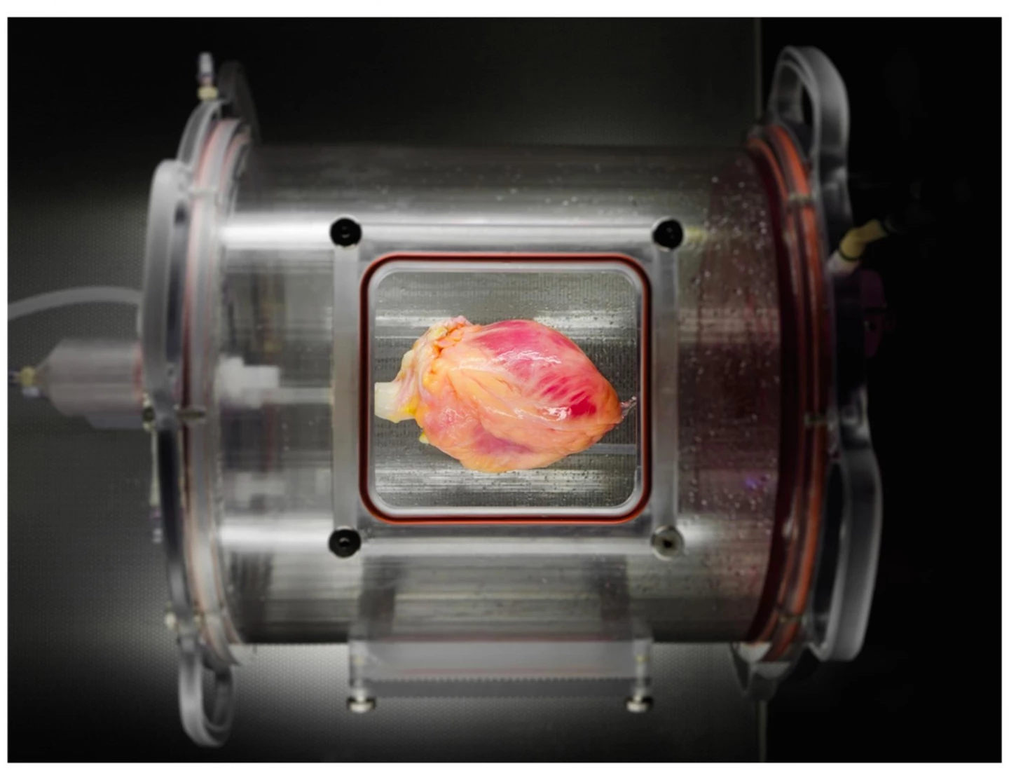 Stripping donor hearts and repopulating them with recipient-derived ...