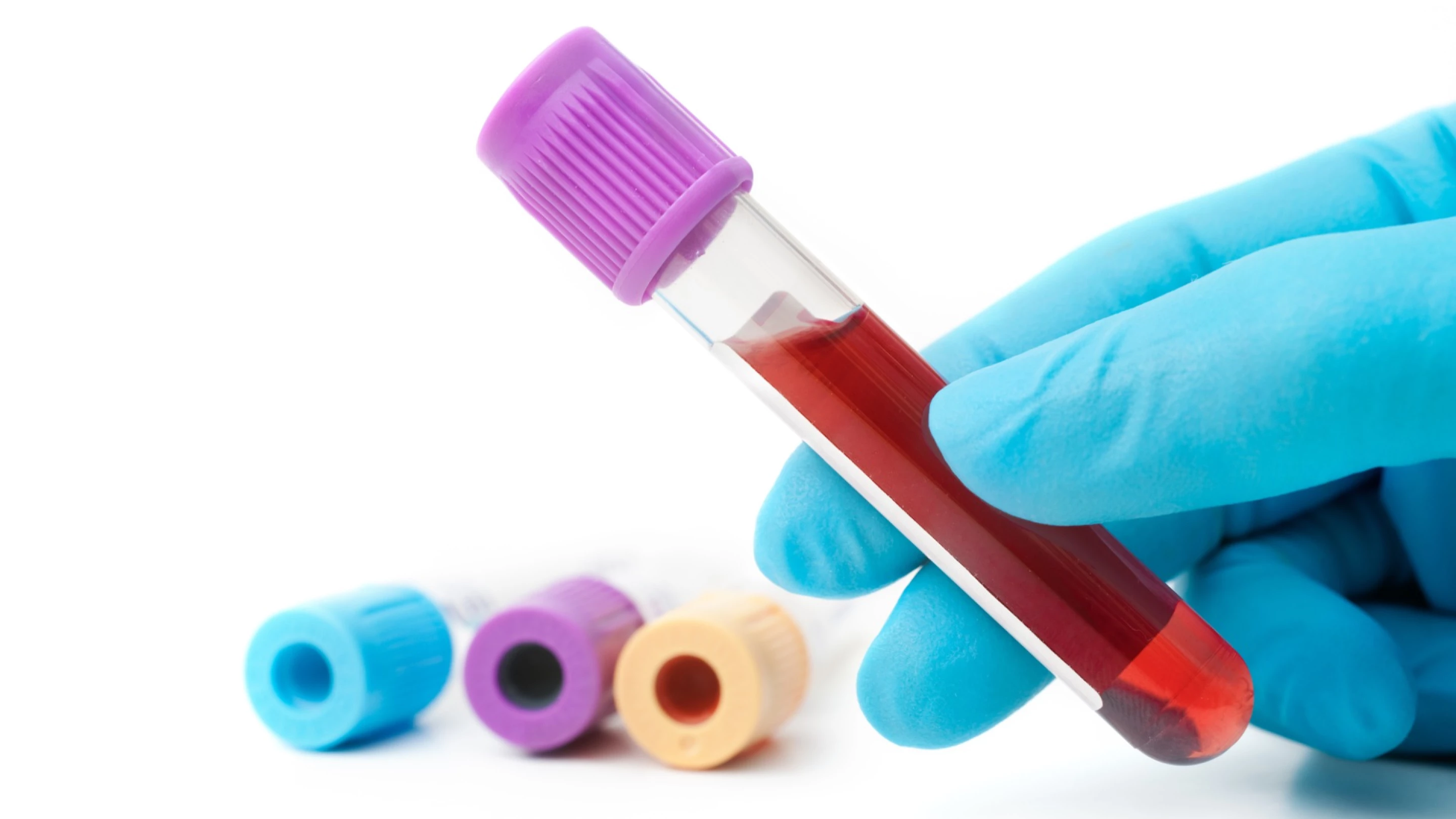 Blood test for eight types of cancer offers promising early results