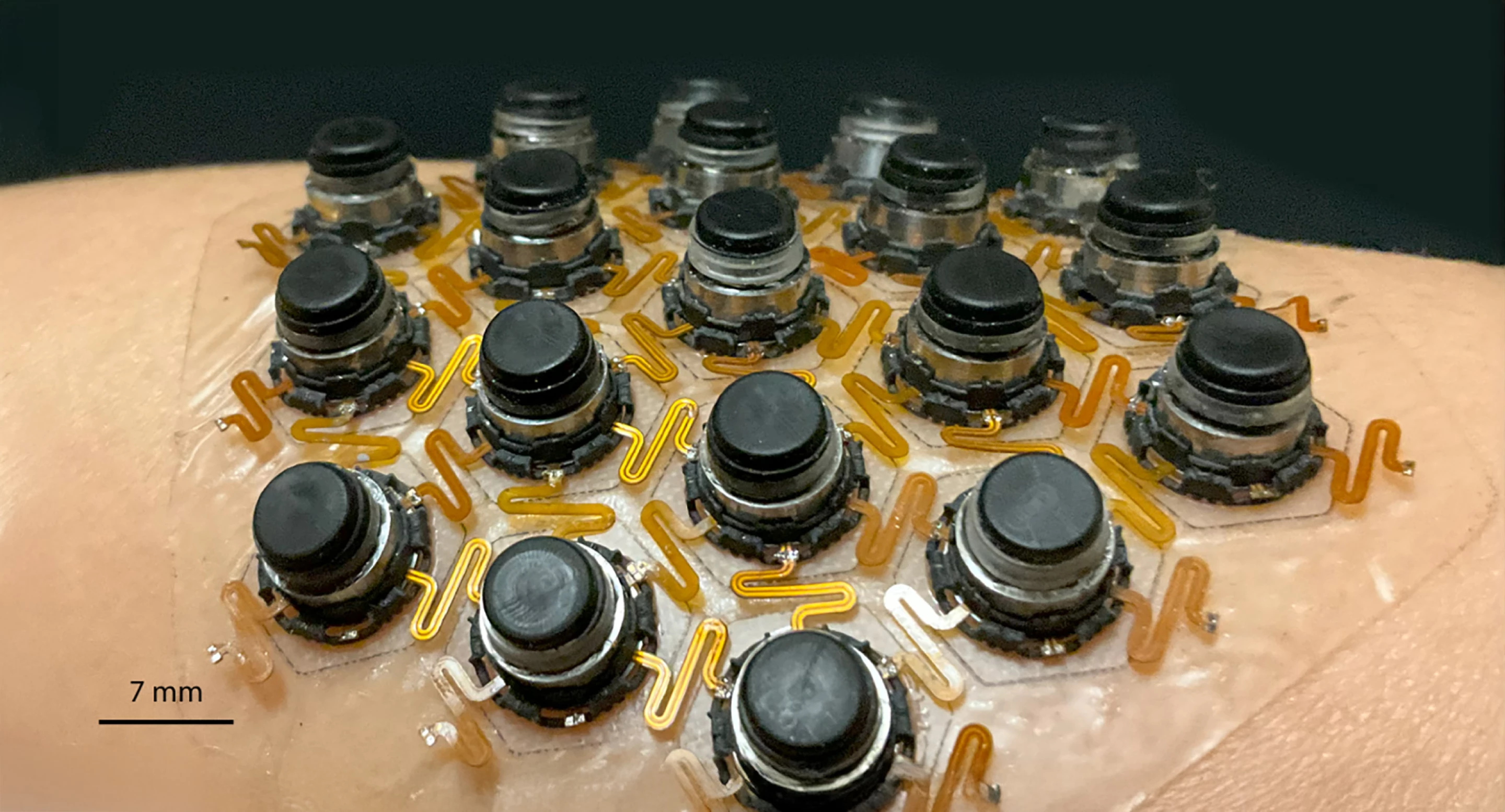 Smart patch buzzes, twists and presses the skin to deliver a sense of touch