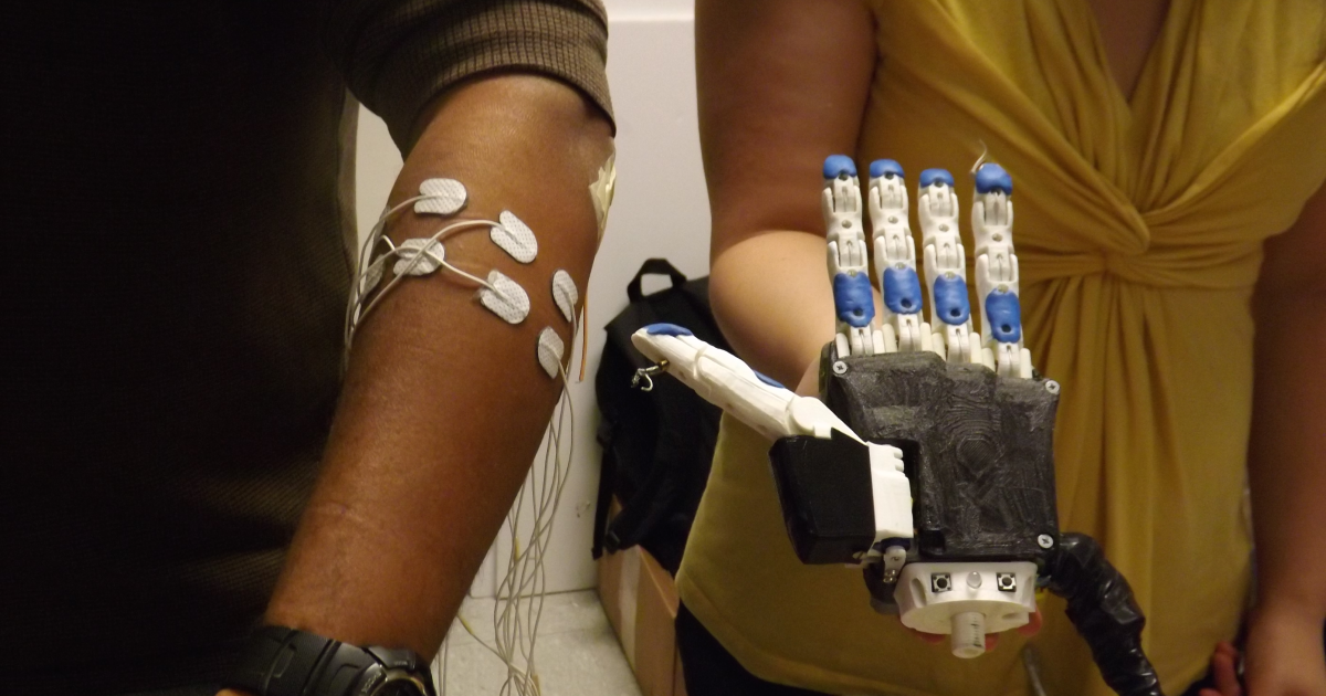 Low cost 3D printed Prosthetic Hand To Be Tested On Amputees In Ecuador low-cost-3d-printed-prosthetic-hand-to-be-tested-on-amputees-in-ecuador