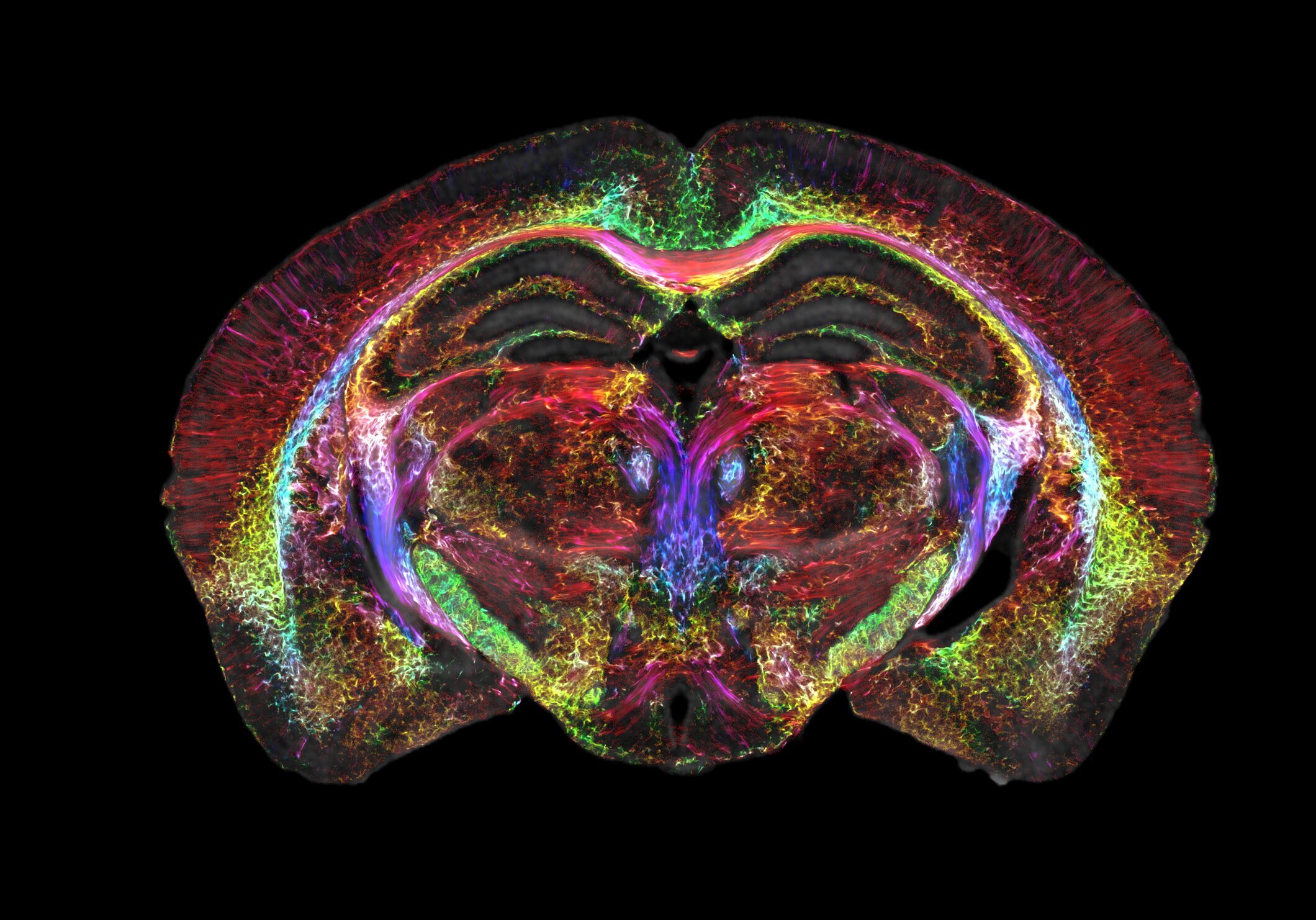 Scans that are 64 million times clearer give a new look at the brain