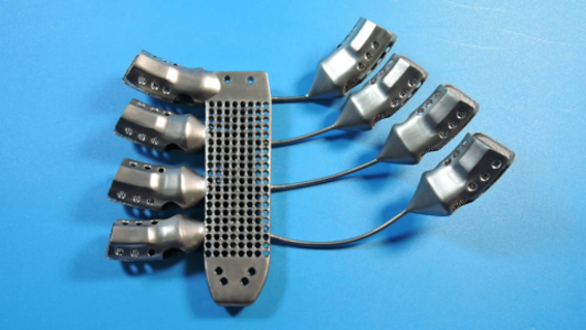 Patient receives 3D-printed titanium sternum and rib cage