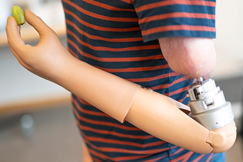 Mind-controlled prosthetic arms "feel" like the real thing