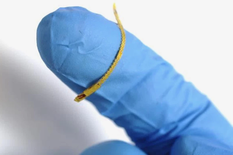 Smart artery stent wirelessly transmits blood flow data