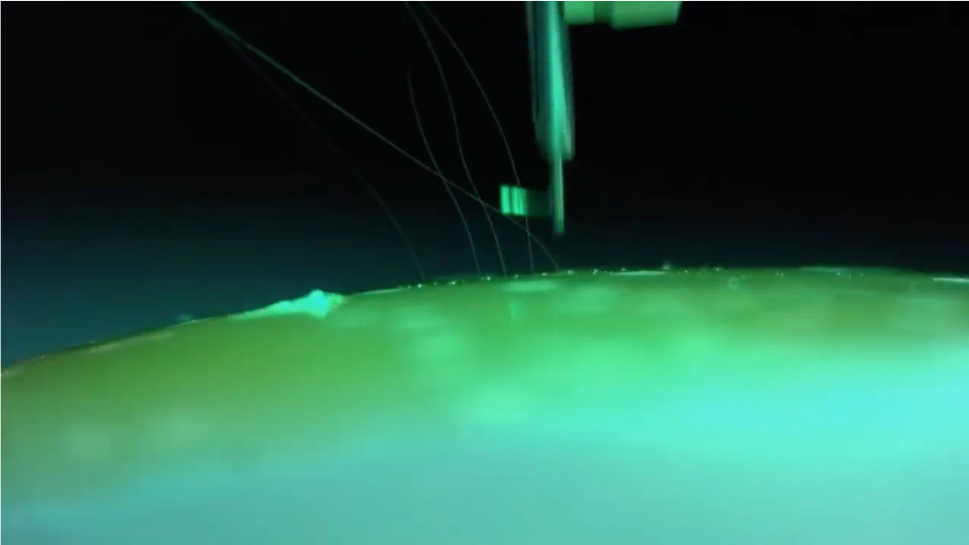 Elon Musk's Neuralink plans its first brain chip implants for next year