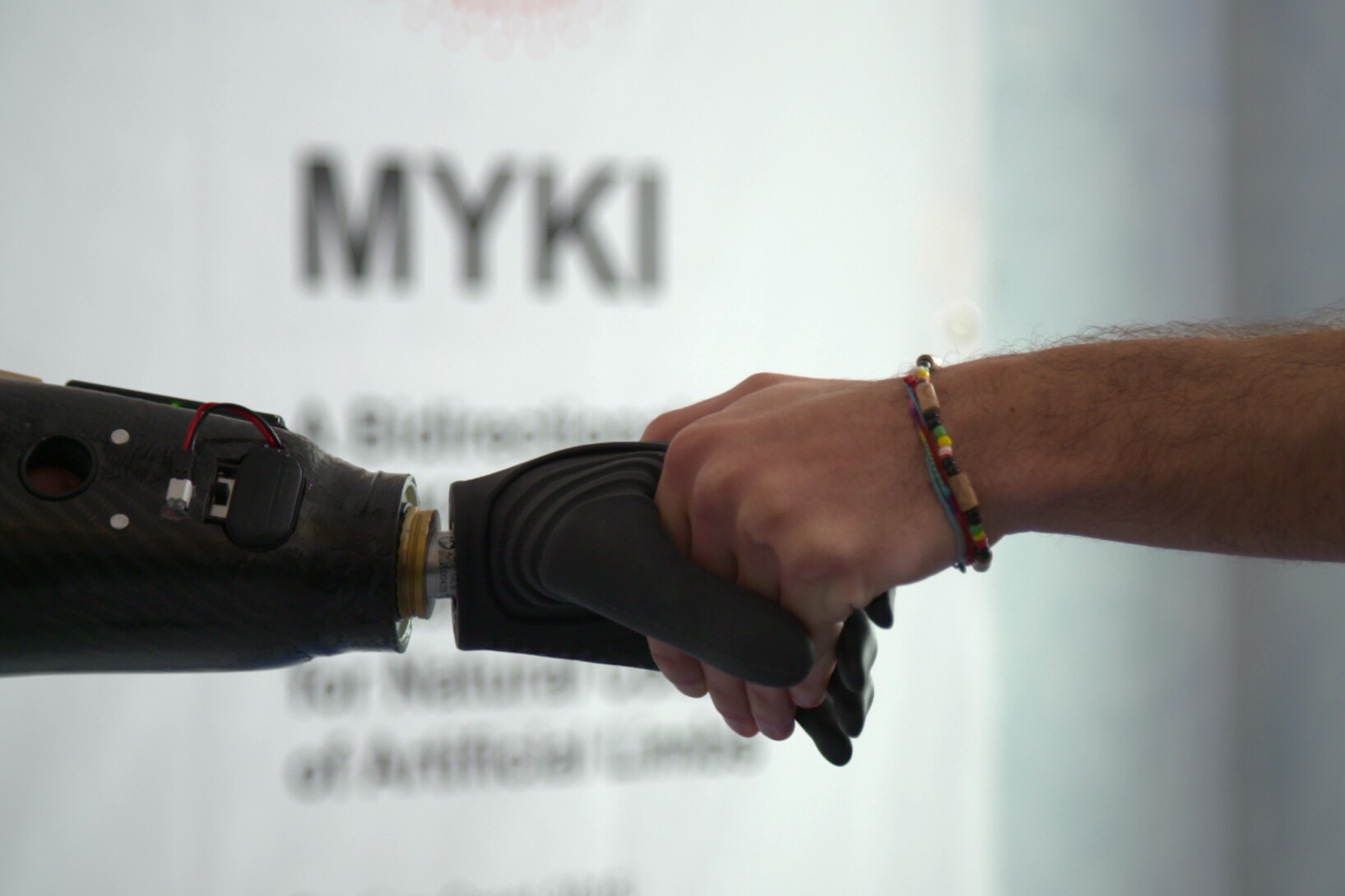 Tiny implanted magnets make for better, simpler control of prosthetic hand