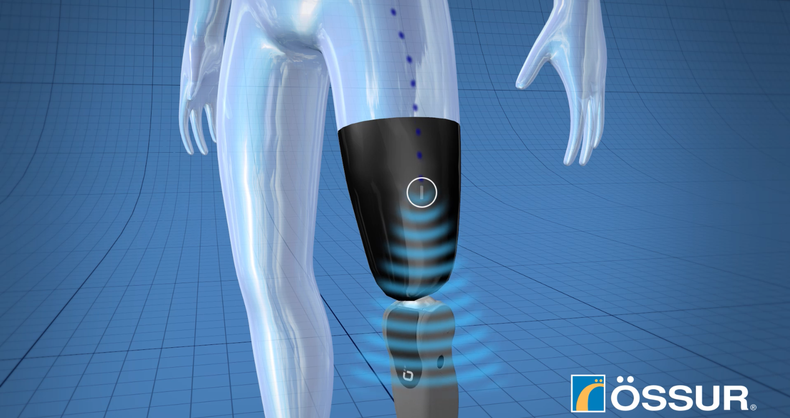Breakthrough bionic leg prosthesis controlled by subconscious thoughts