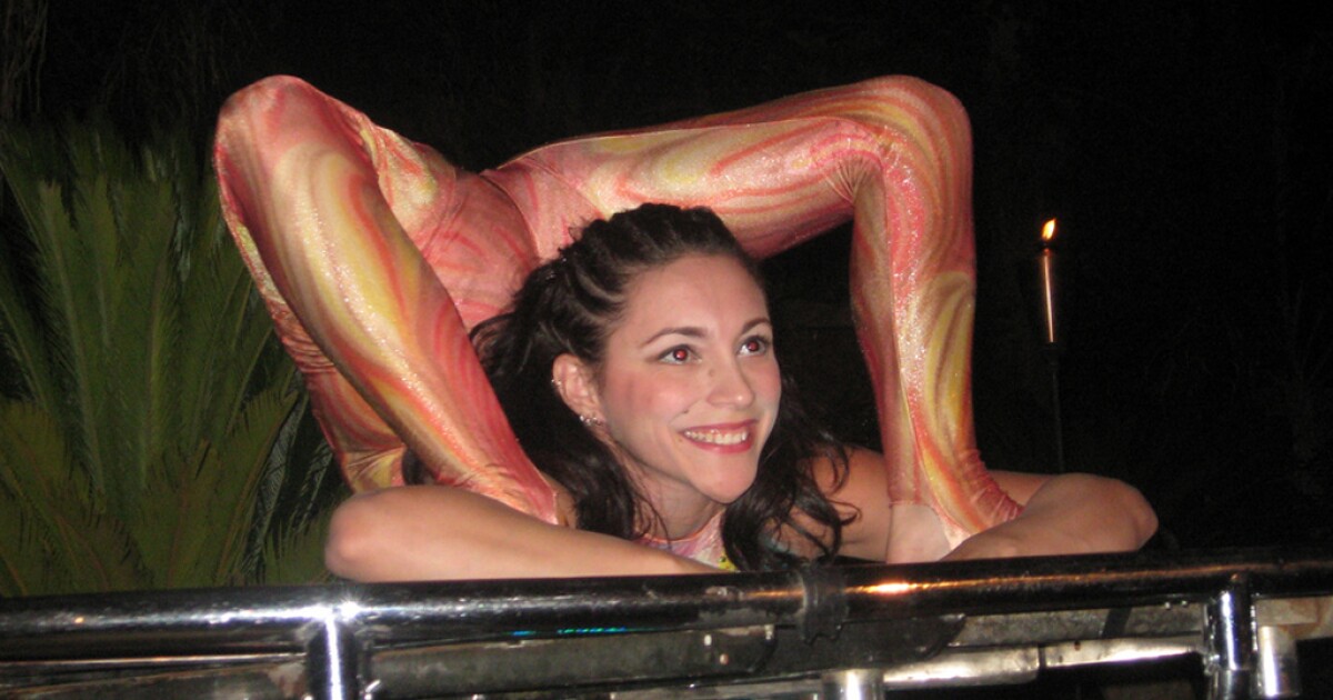 Bioengineered spinal disc implants to combat back pain