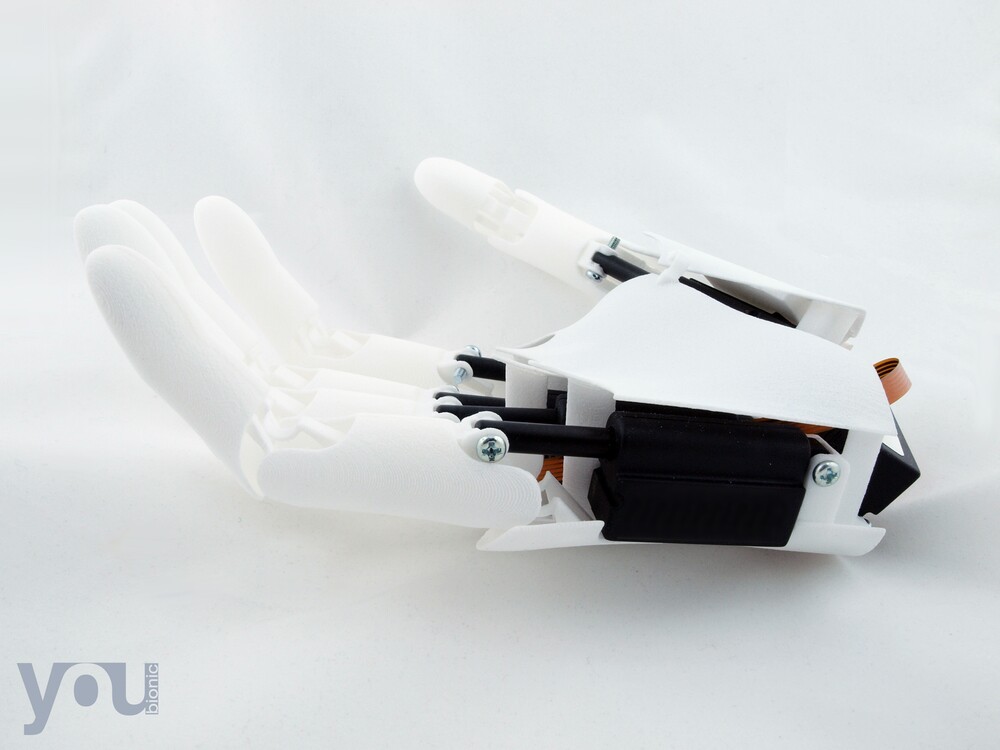 Youbionic developing low-cost 3D-printed bionic hand