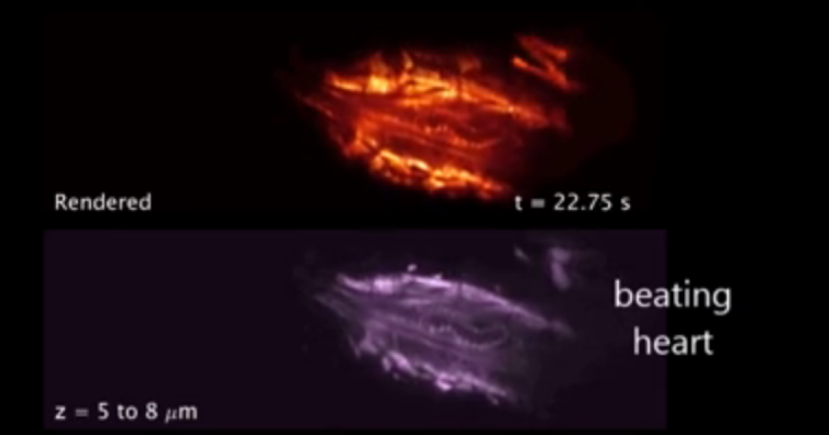 "SCAPE" microscope offers faster and simpler imaging of freely moving ...