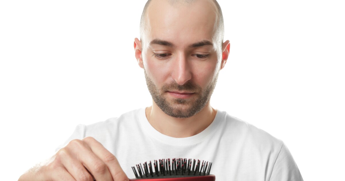 Stem Cell Breakthrough Brings Baldness Cure One Step Closer