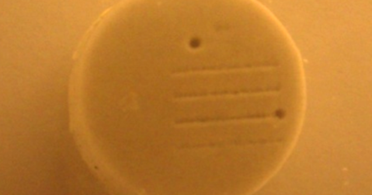 Sonic "invisible scalpel" could be used for non-invasive surgery