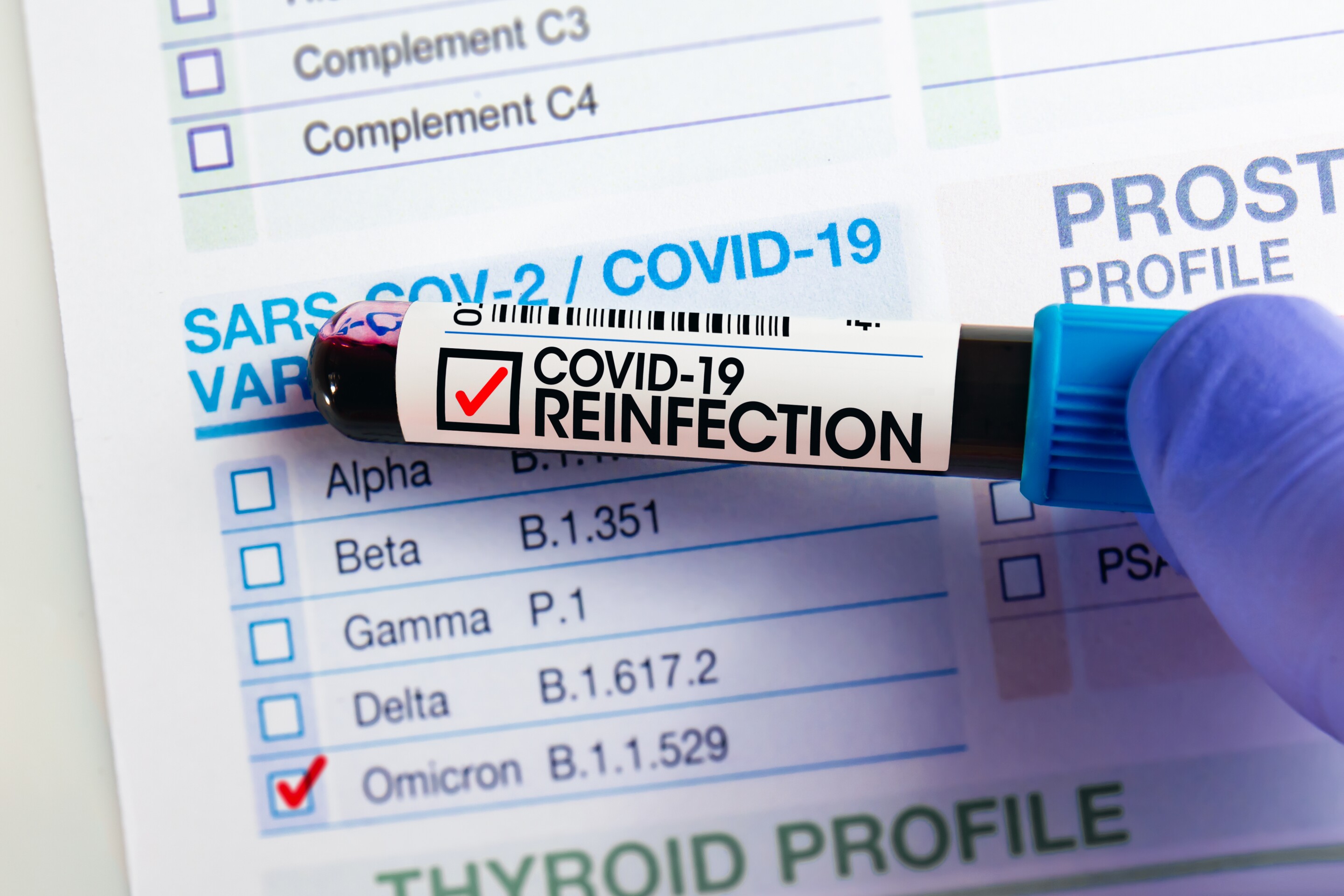 Repeated COVID infections pose significant health risks, study warns Repeated COVID infections pose significant health risks, study warns
