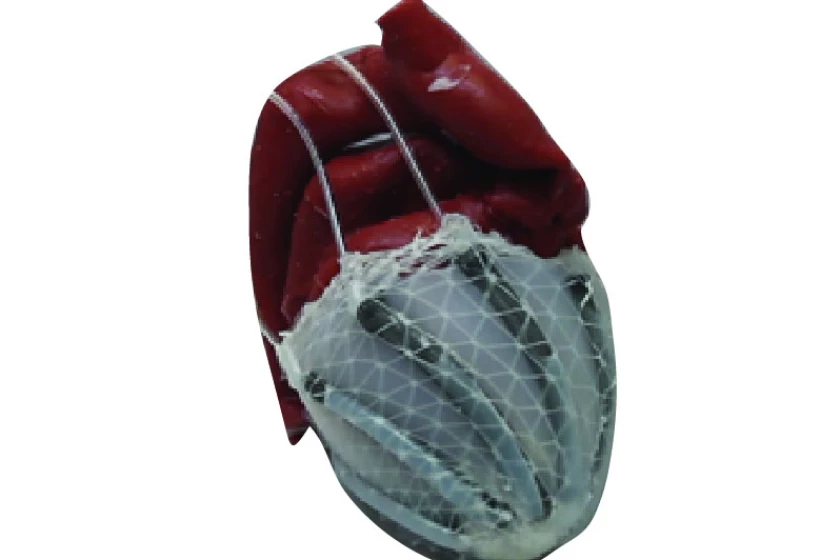 Soft robotic heart sleeve helps pump blood
