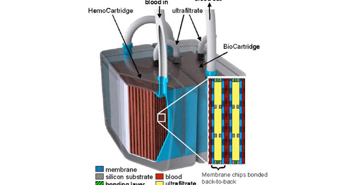 first artificial kidney