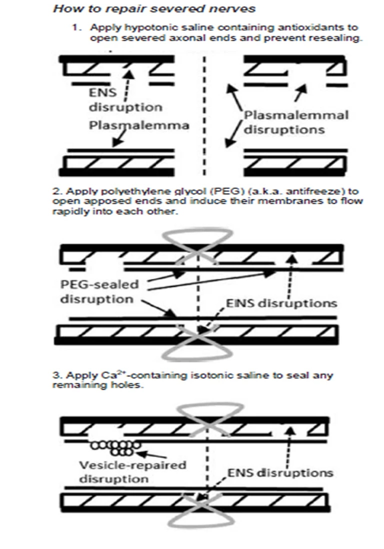 Non-surgical procedure repairs severed nerves in minutes