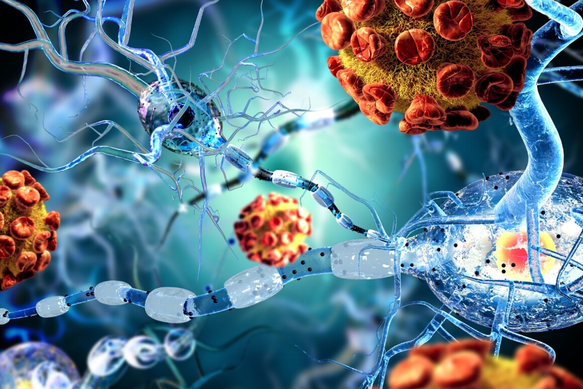 Immune cells from the gut found to reduce MS-related brain inflammation