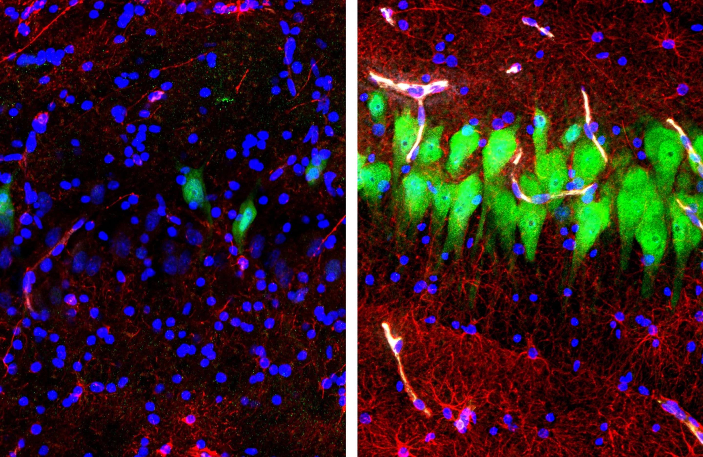 Brain function partially restored in pigs – four hours after death