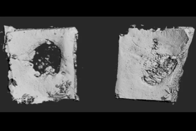 Implantable bio-patch grows bone where it's needed