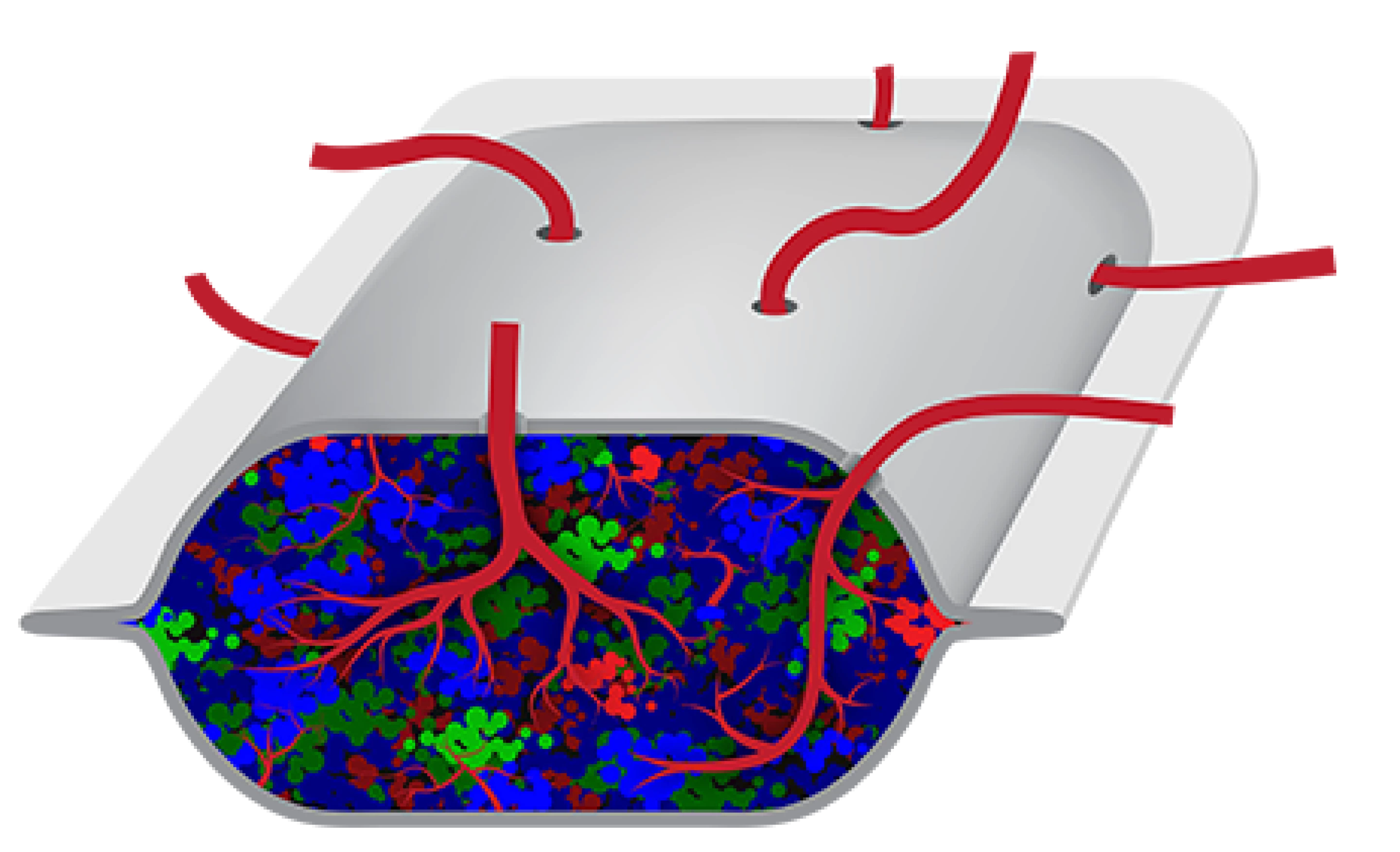 Clinical trials of stem cell-based "functional cure" for type 1 ...