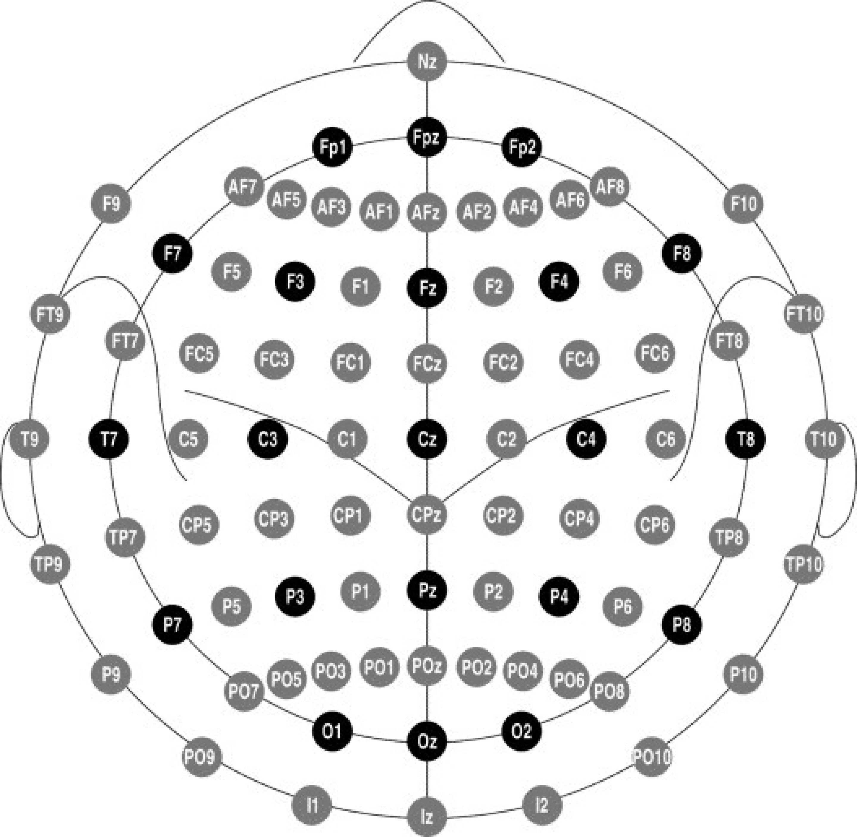 3D-printed EEG headset from OpenBCI is customizable and open-source
