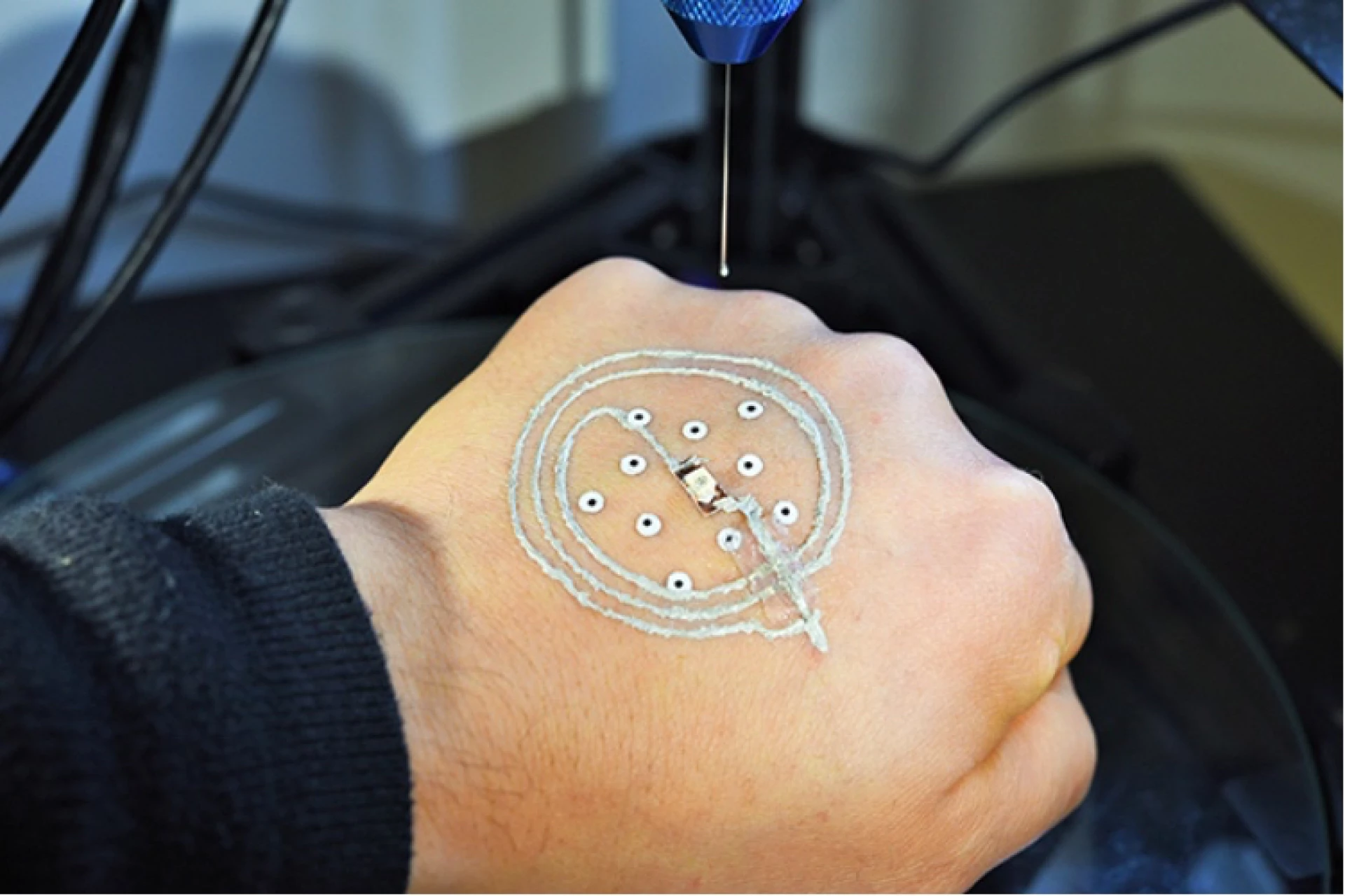 Electronics 3D-printed onto human skin