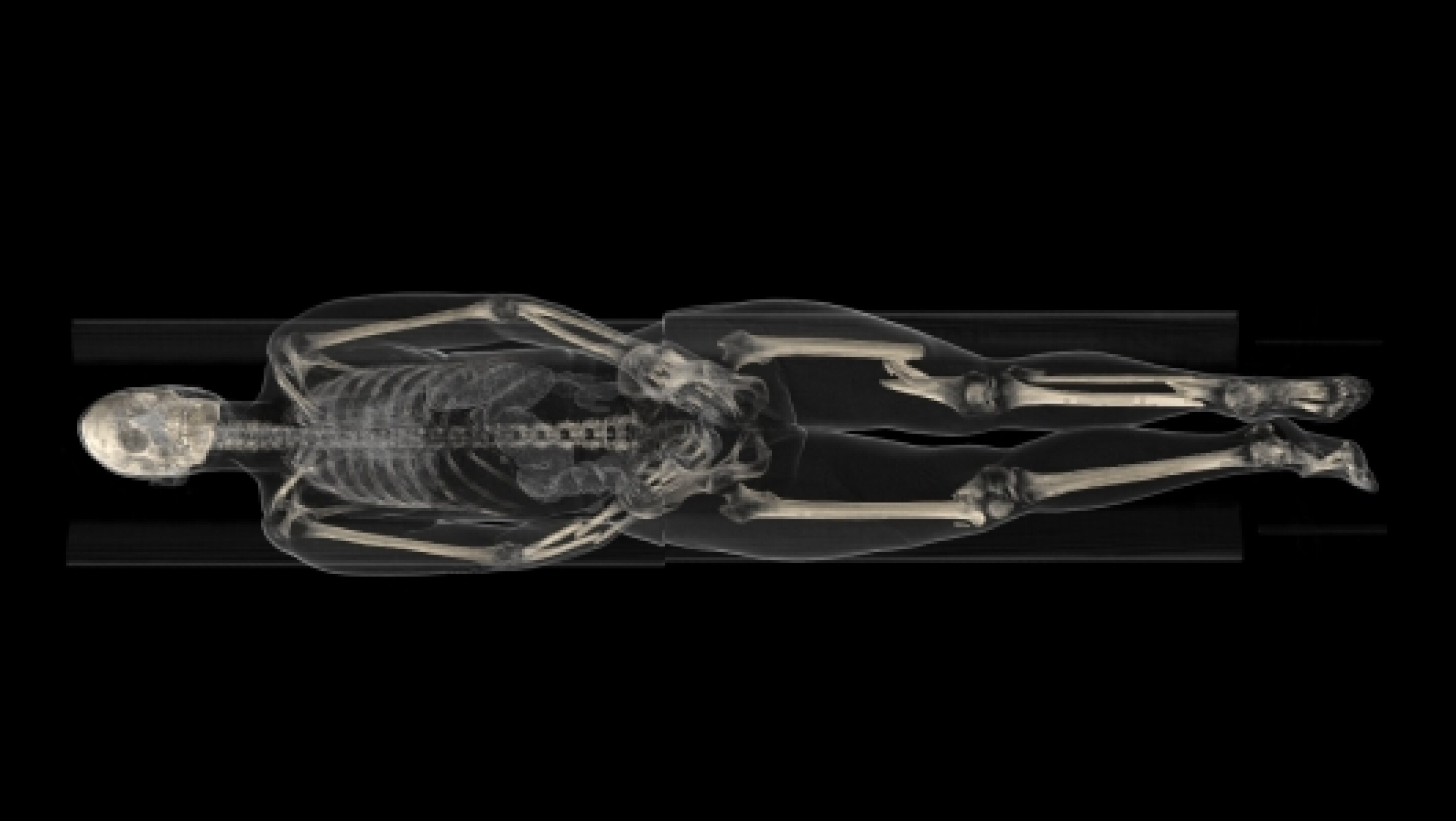 The interactive 3D Virtual Autopsy Table