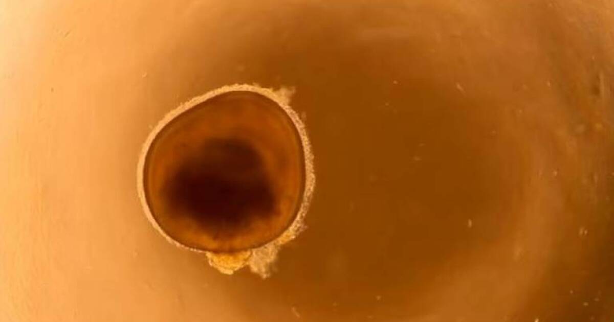 Scientists grow mini eyes in lab dishes to study blindness