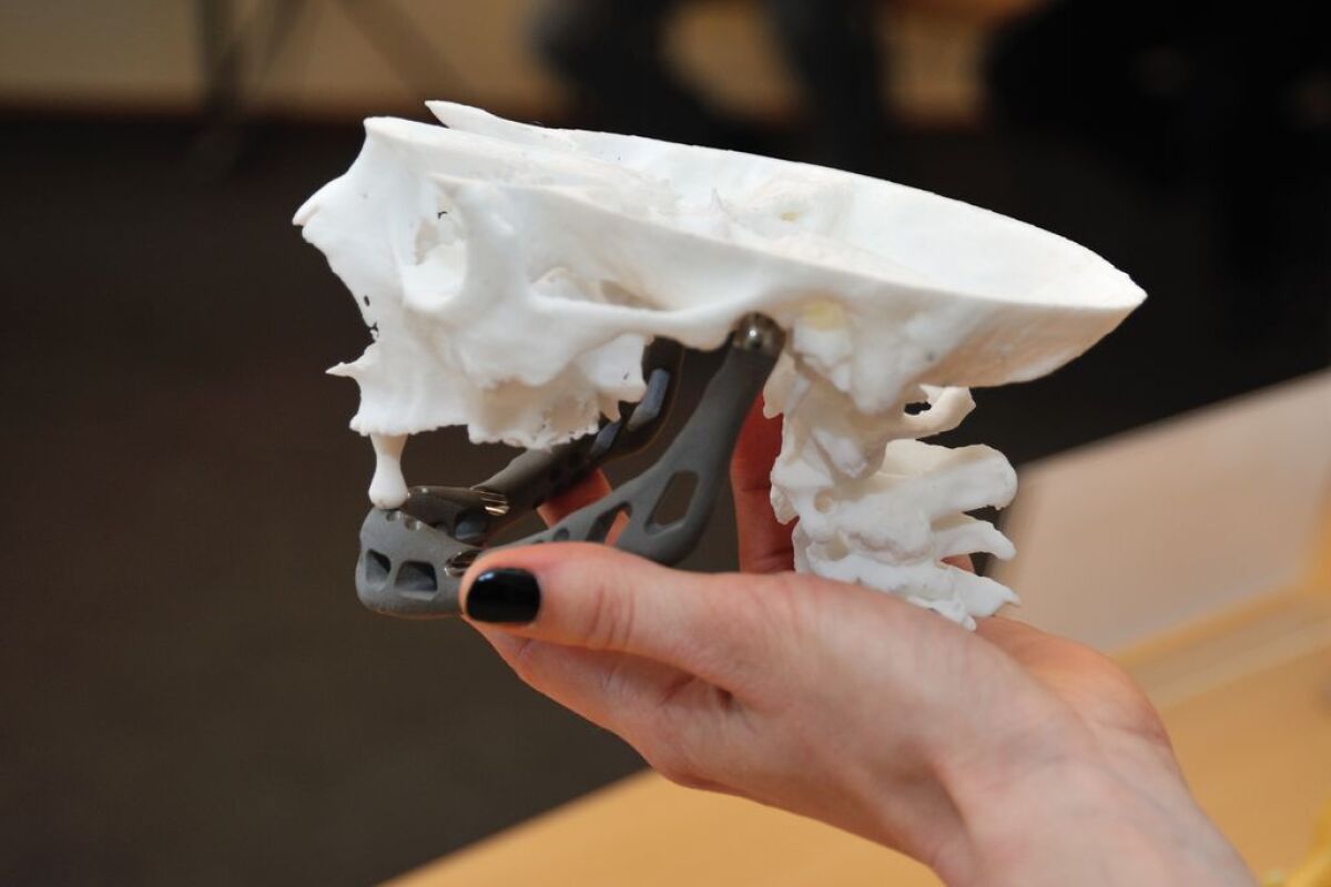 3d printed jaw
