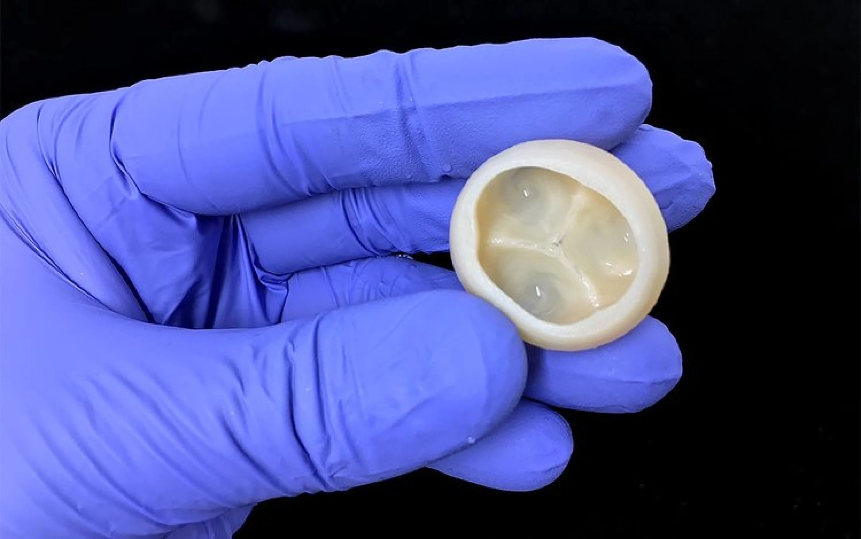 3D bioprinting breakthrough leads to full-scale, functioning heart parts