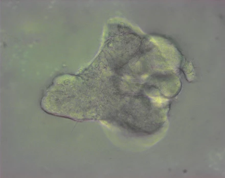 Scientists create functioning "mini-lungs" to study cystic fibrosis