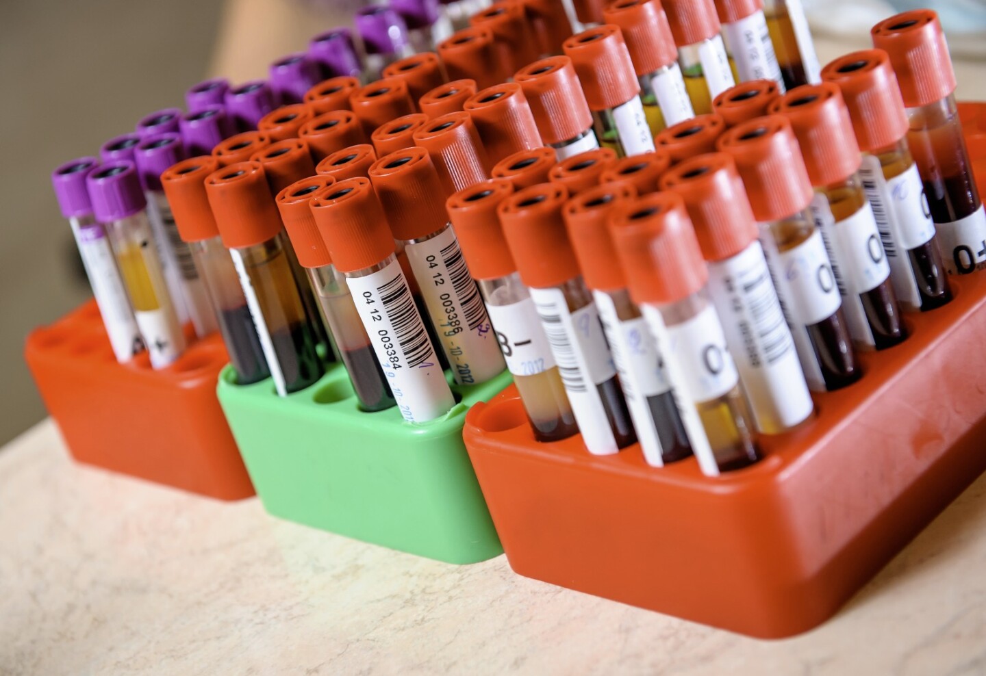 Could a blood test accurately diagnose autism?