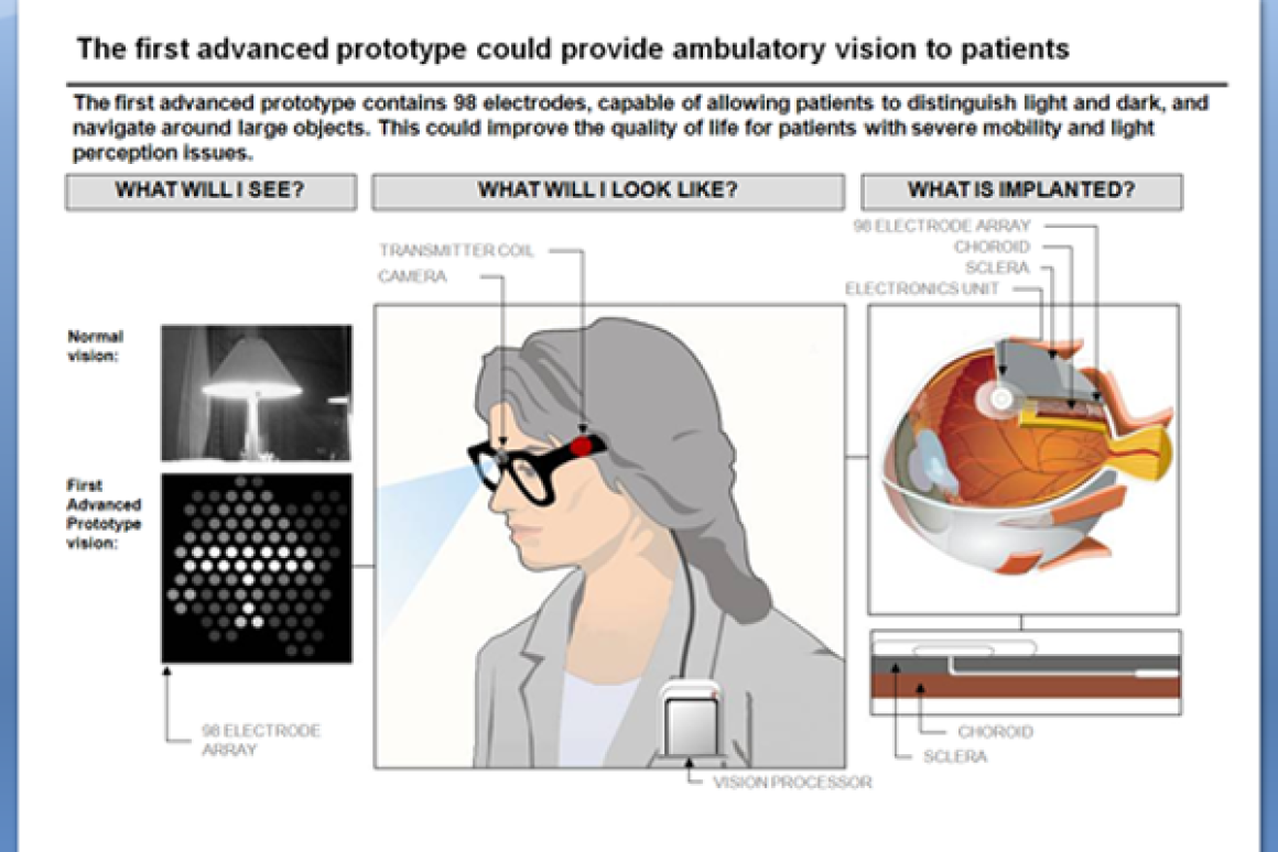 First advanced prototype revealed for the Australian bionic eye